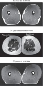 Insight 2: Skeletal muscles, aging and consequences - Longevitybuilder ...